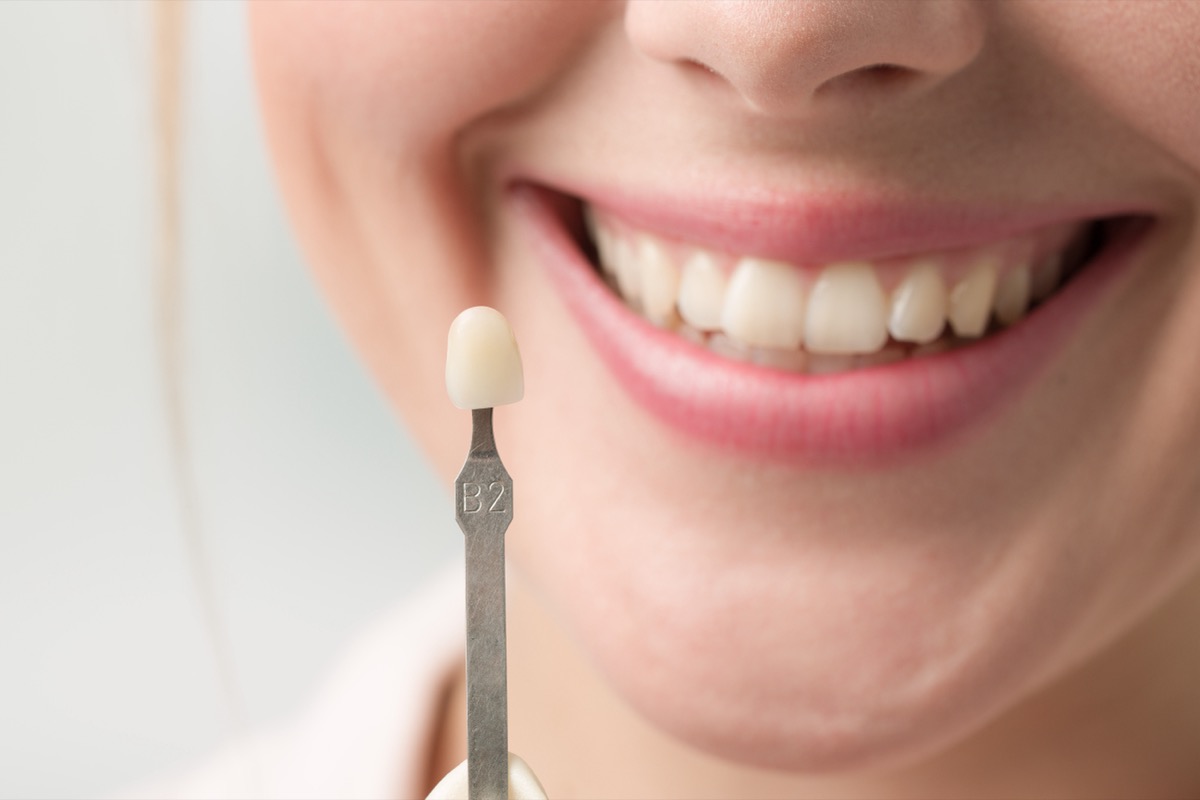 Immediate Dentures | Marlborough Denture Clinic | Calgary, AB